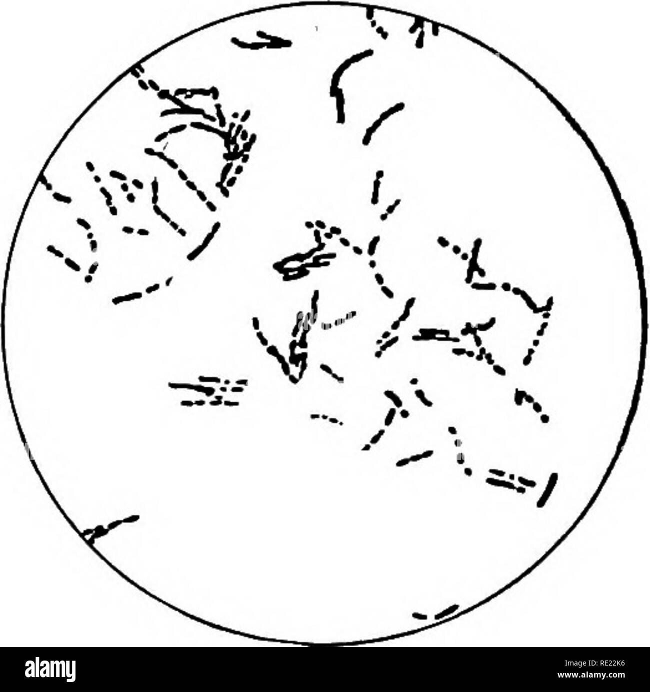 . A text-book of bacteriology. Bacteriology. BACILLI IN CHRONIC ...