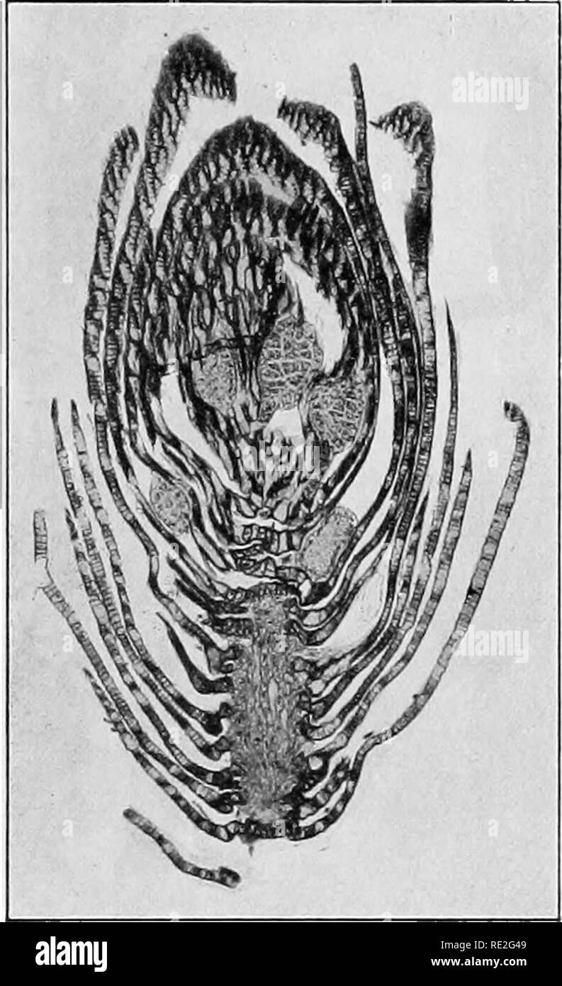 Moss Archegonial Head