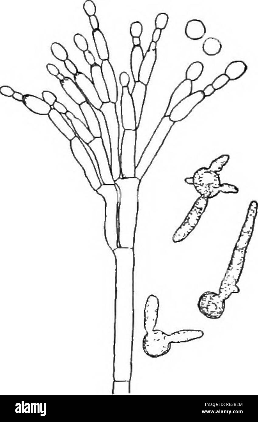 Sac Fungi Diagram