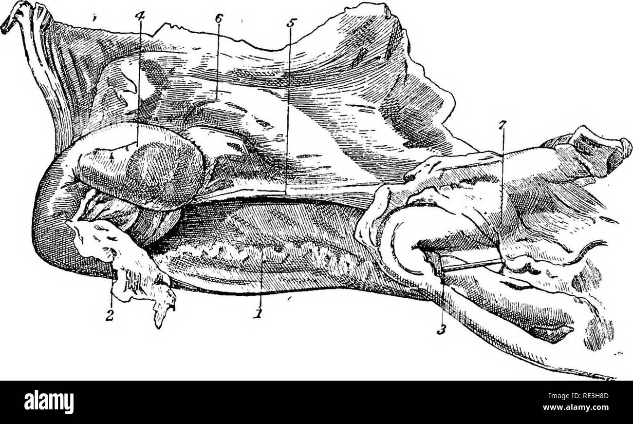 Ovary cysts Black and White Stock Photos & Images - Alamy