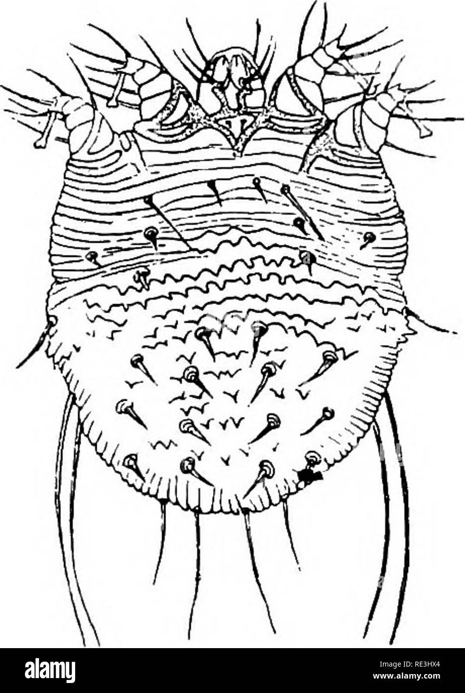 Sarcoptes scabiei scabies hi-res stock photography and images - Alamy