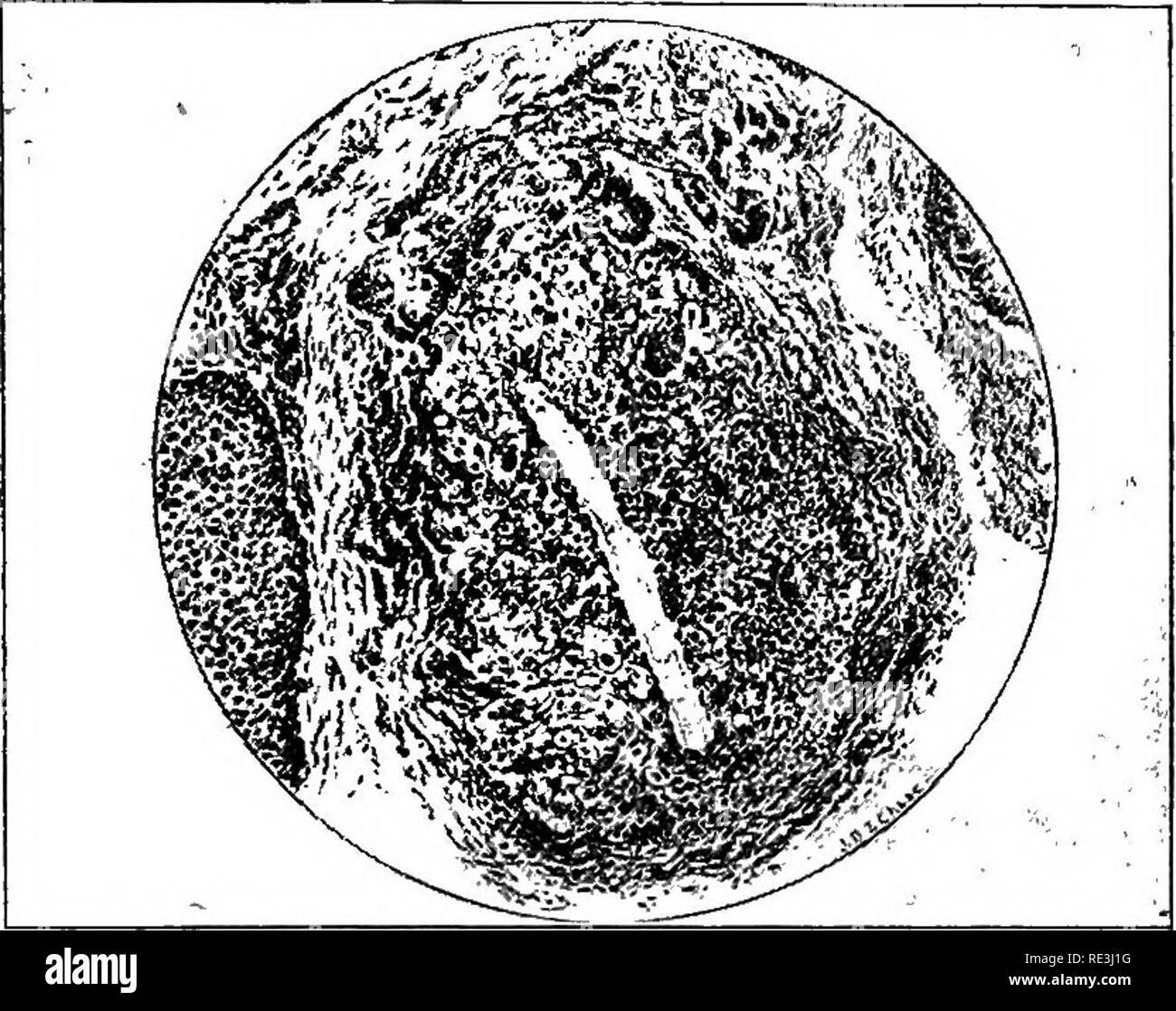 Tic insect Black and White Stock Photos & Images - Alamy