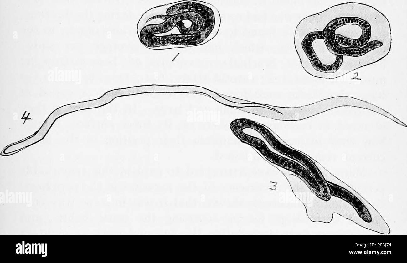 Microfilariae hi-res stock photography and images - Alamy