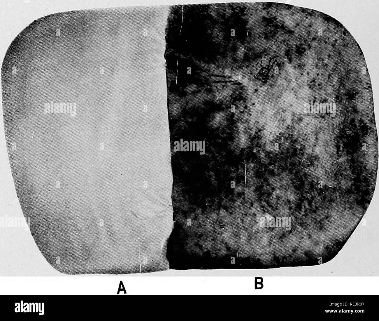 Swine erysipelas hi-res stock photography and images - Alamy