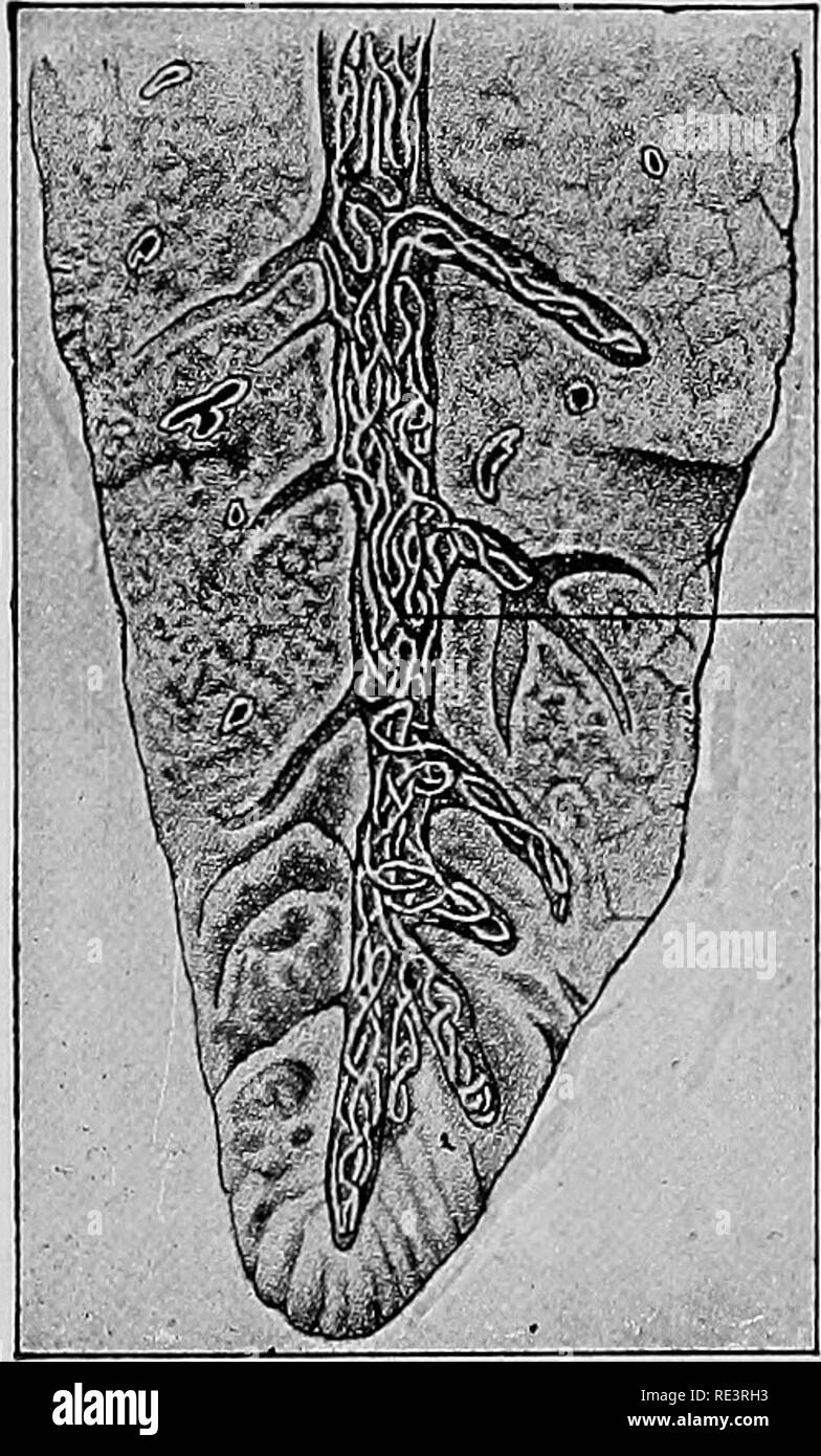 Mucus in bronchial tubes hi-res stock photography and images - Alamy