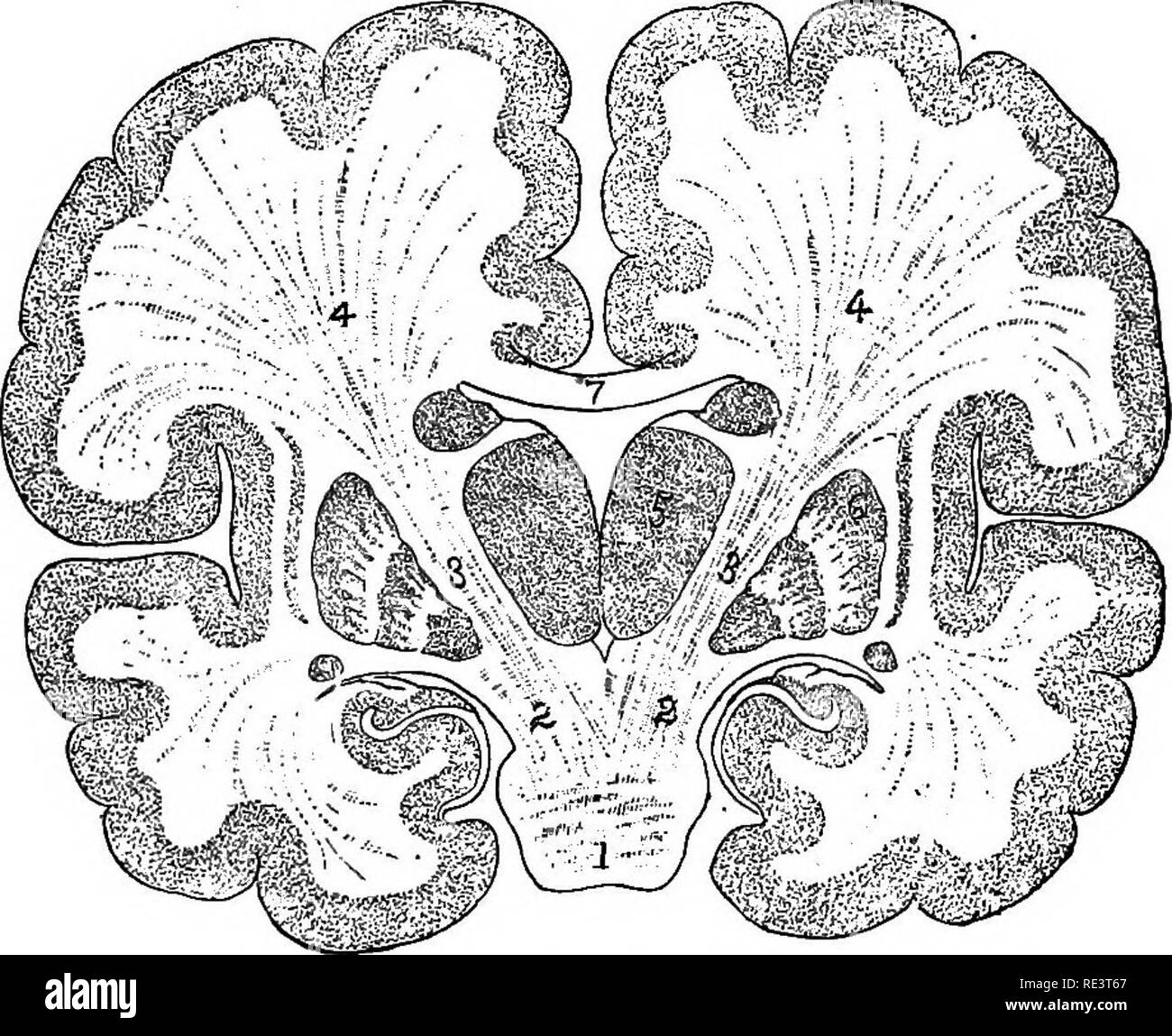 Brain Transverse Section Black and White Stock Photos & Images - Alamy