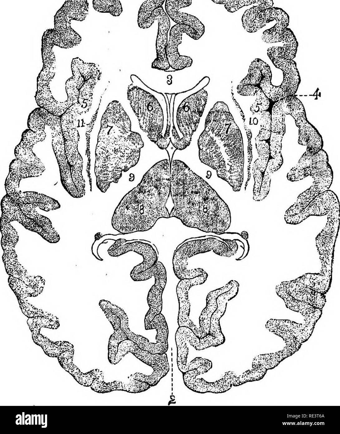 Brain Transverse Section Black and White Stock Photos & Images - Alamy