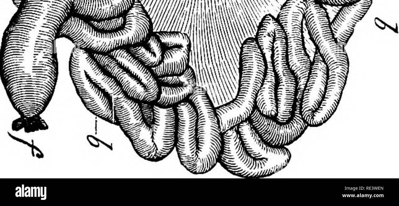 Large intestine mesentery Black and White Stock Photos & Images - Alamy