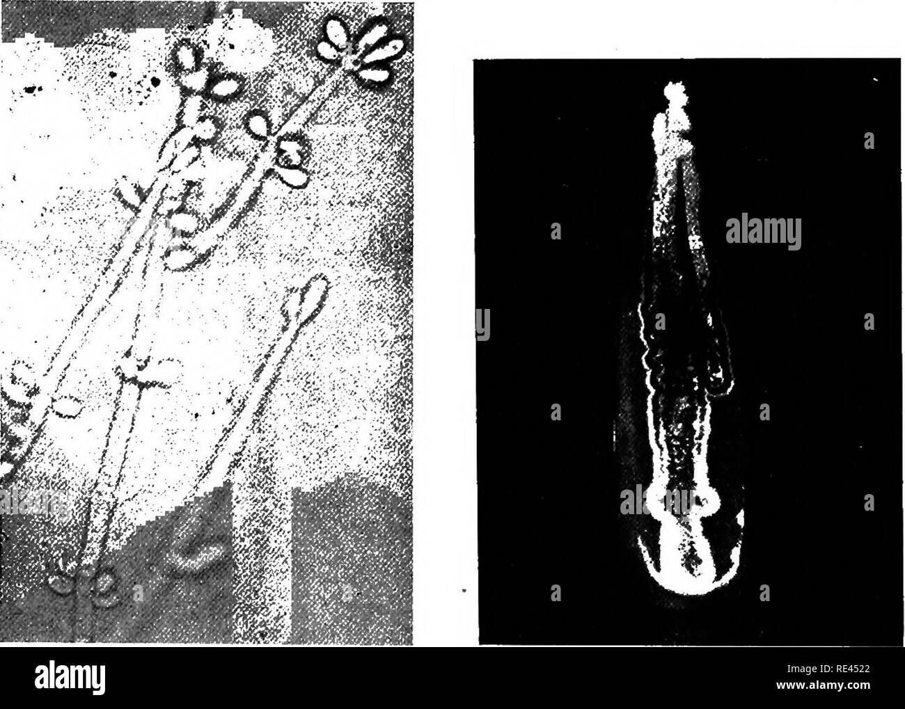 Sporotrichosis hi-res stock photography and images - Alamy