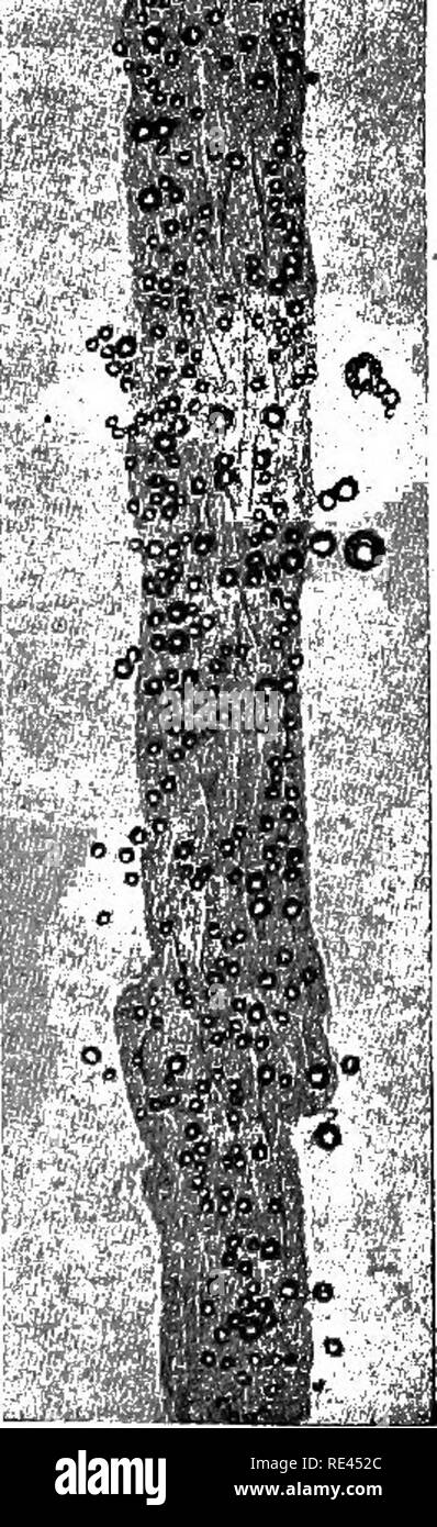 Rows of bodies at b hi-res stock photography and images - Alamy