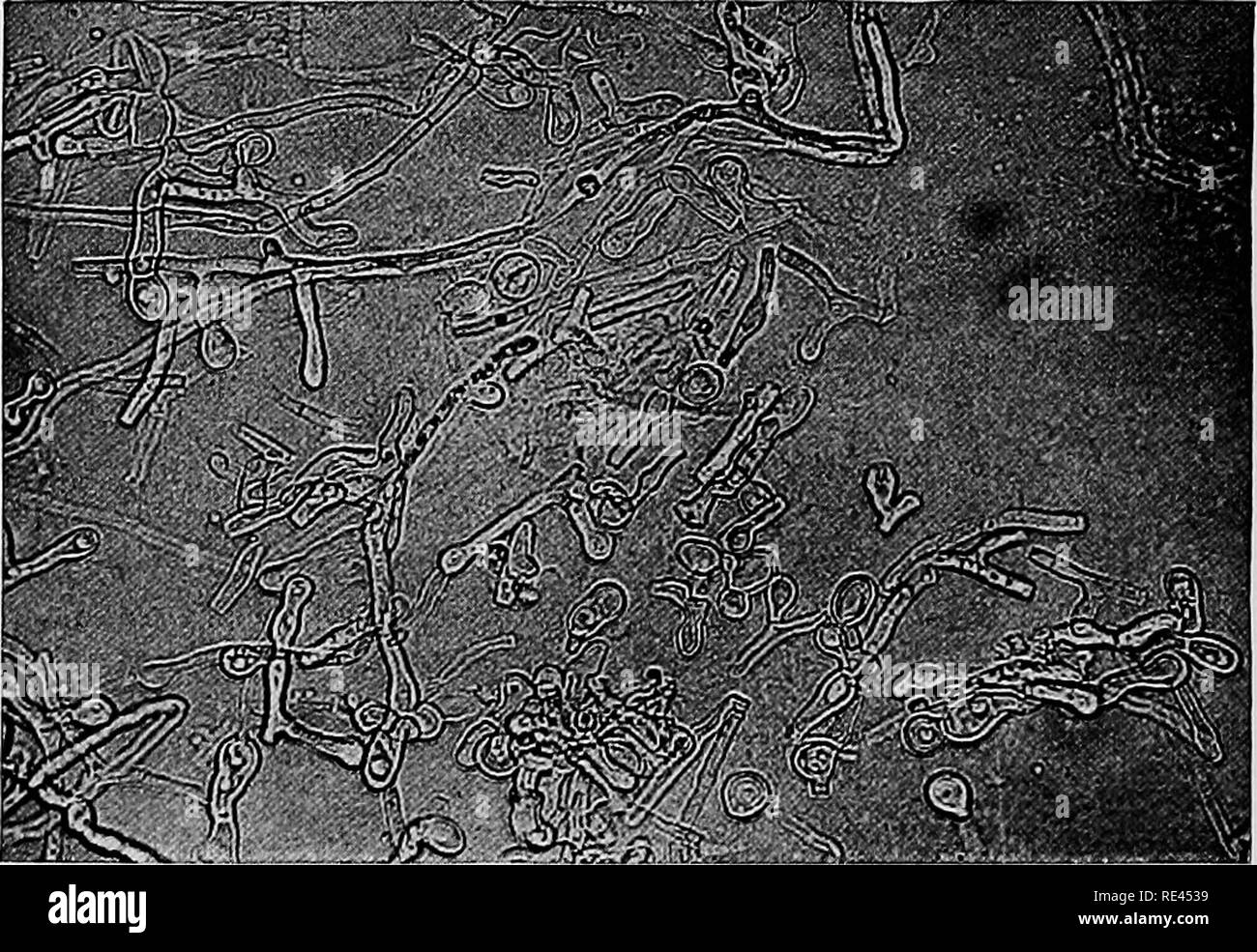 Small bacteria colonies hi-res stock photography and images - Alamy
