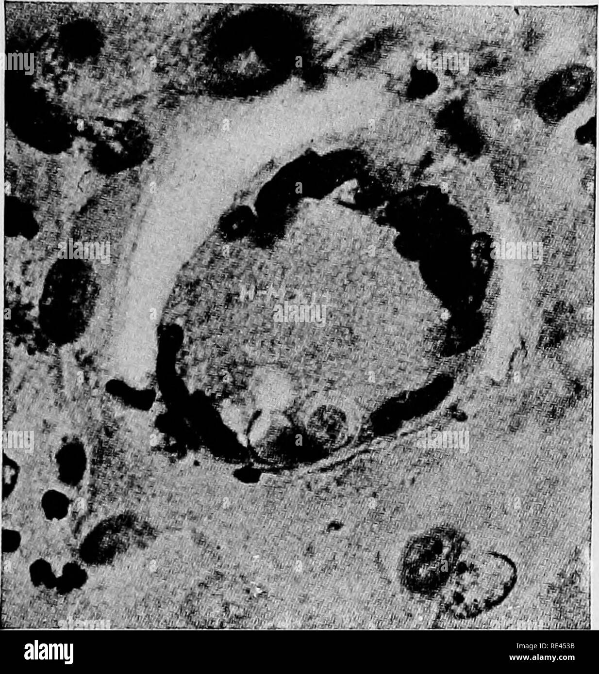 Elliptical spores hi-res stock photography and images - Alamy