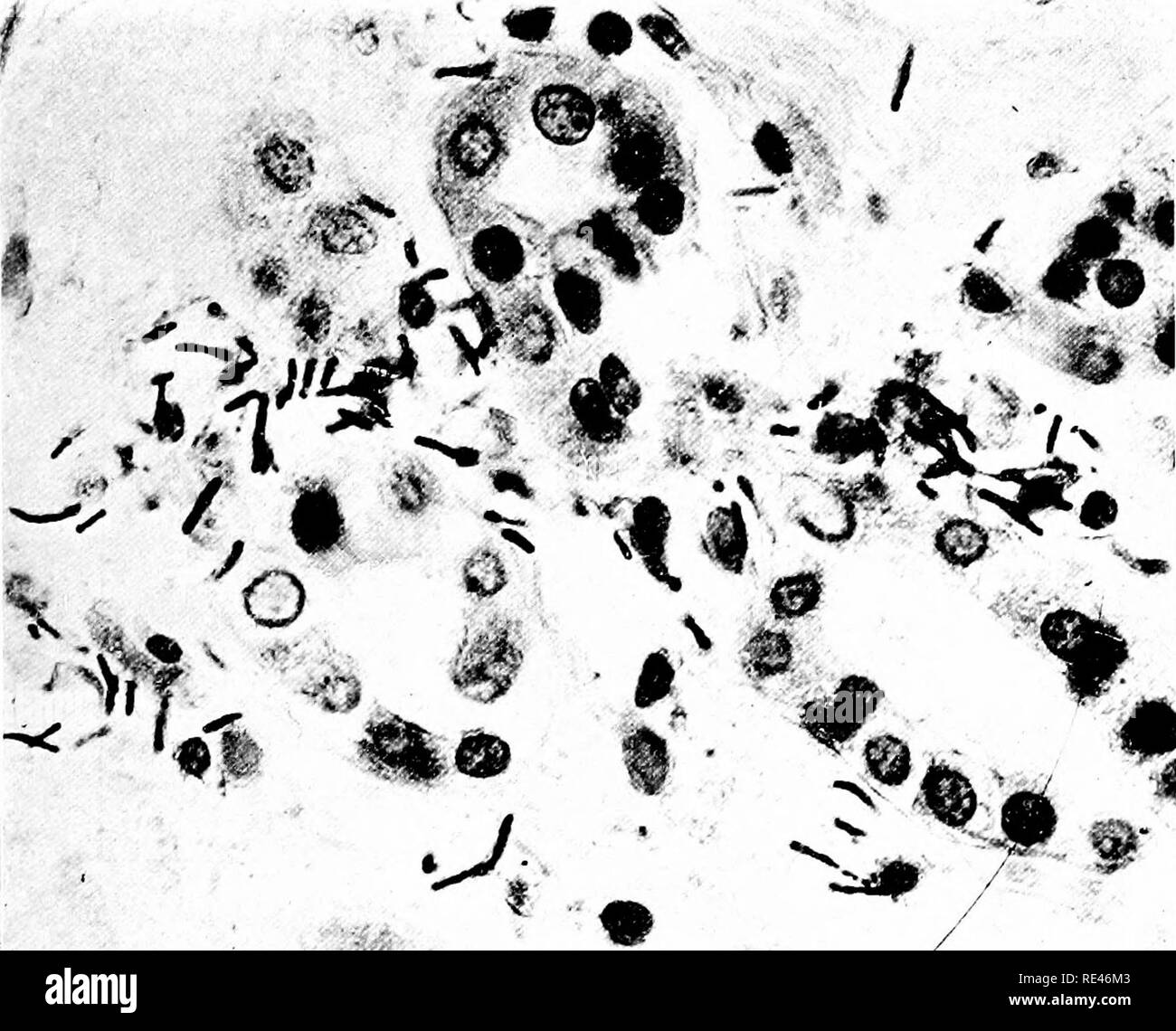 Spore stain Black and White Stock Photos & Images - Alamy