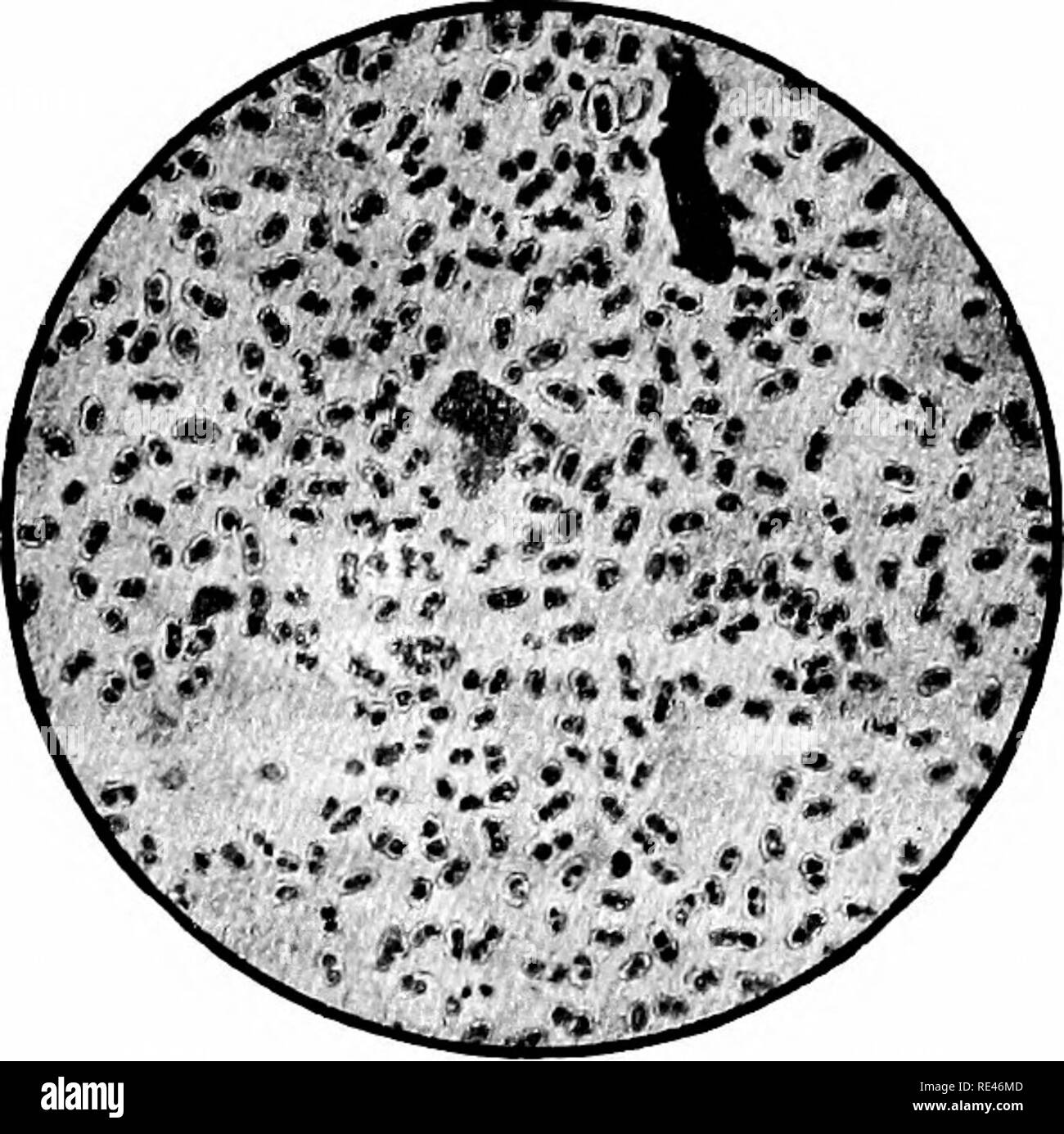 Buboes hi-res stock photography and images - Alamy