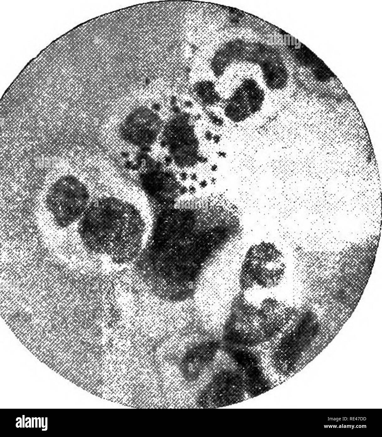 Gonococci hi-res stock photography and images - Alamy