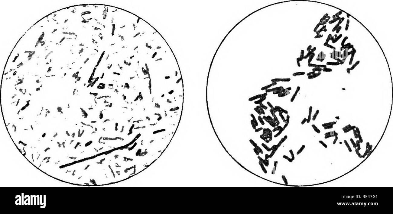 Fever to the form Black and White Stock Photos & Images - Alamy