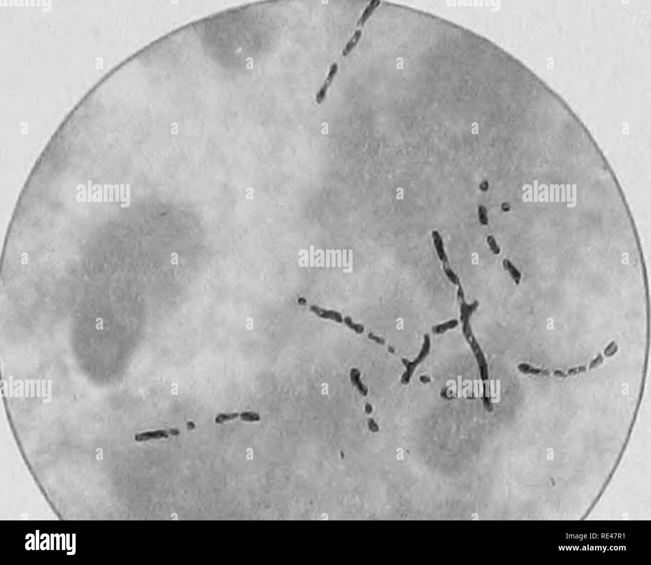 Appearance of new tissue Black and White Stock Photos & Images - Alamy