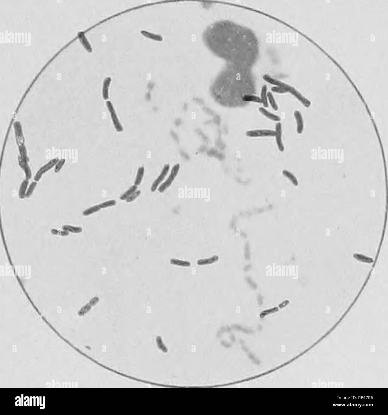 Tubercle bacilli Black and White Stock Photos & Images - Alamy