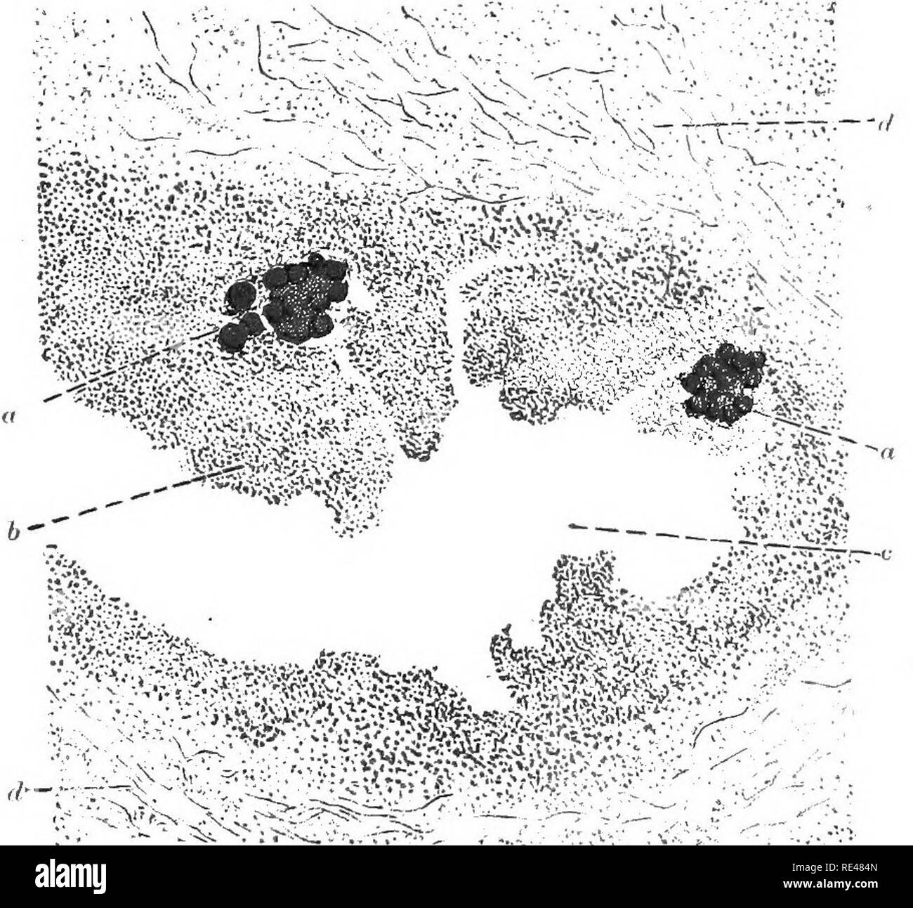 Pus cells Black and White Stock Photos & Images - Alamy