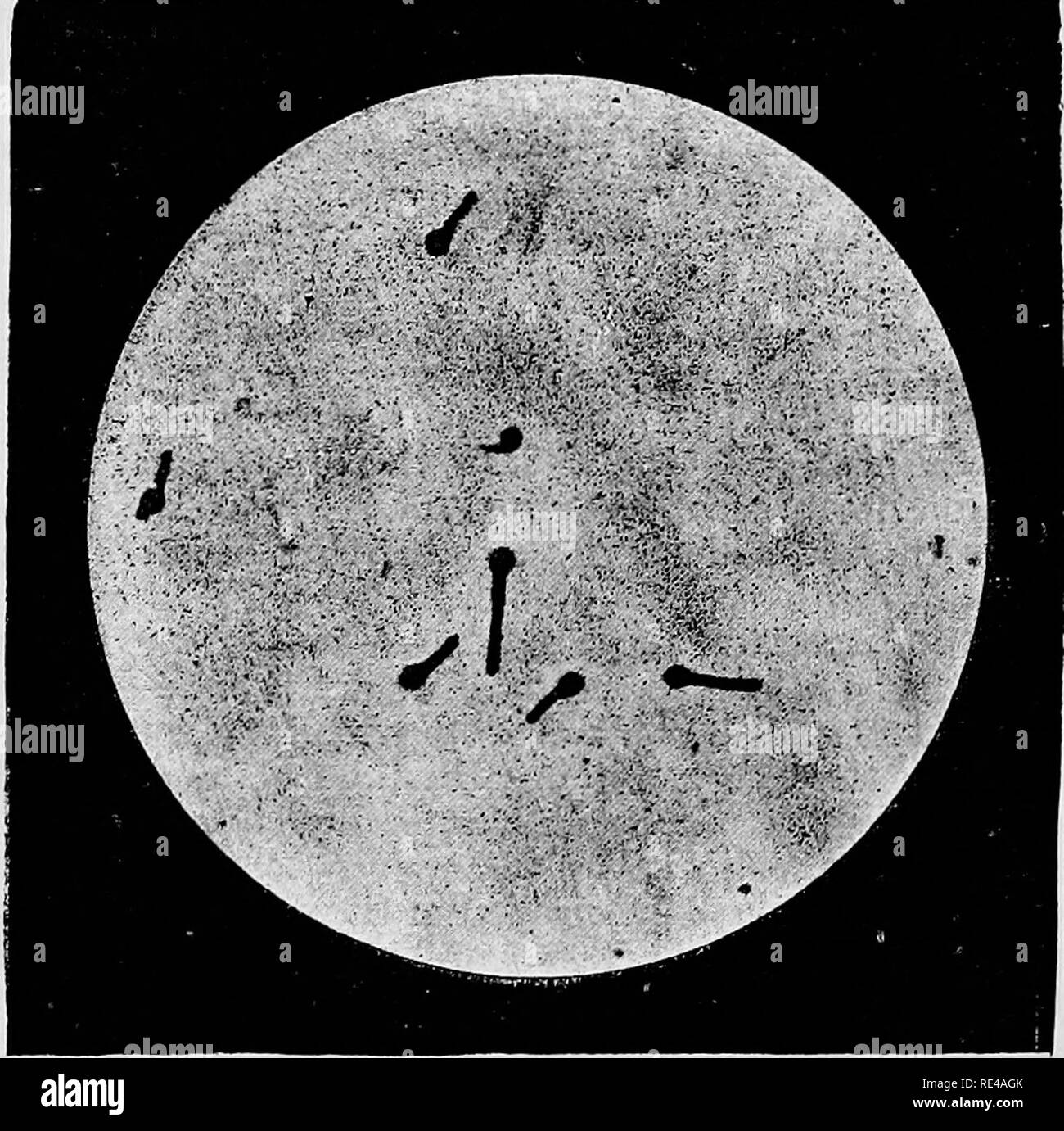 Tetanus bacillus Black and White Stock Photos & Images - Alamy