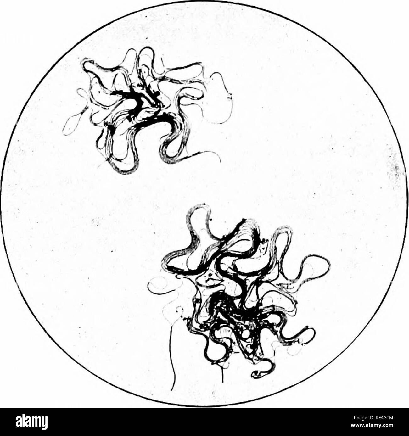 Bacillus anthracis colonies hi-res stock photography and images - Alamy