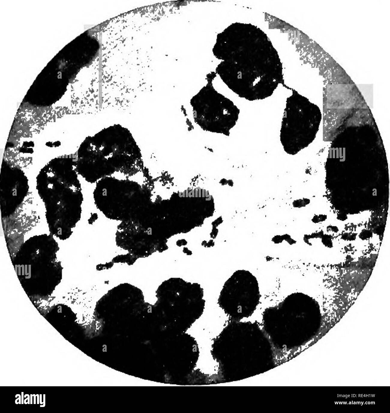 Chancroid bacteria hi-res stock photography and images - Alamy