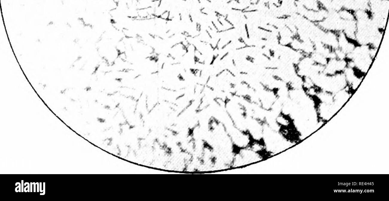 Micro dist hi-res stock photography and images - Alamy