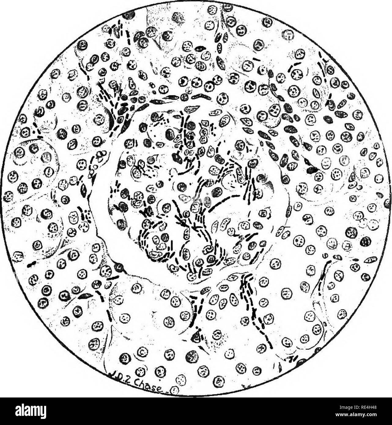 Malignant pustule bacteria hi-res stock photography and images - Alamy