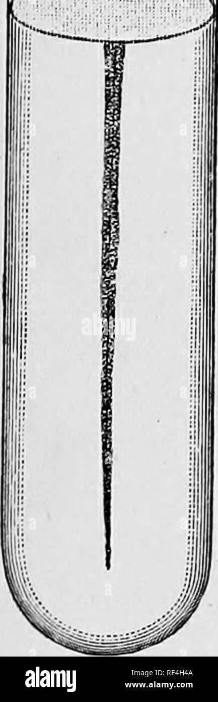 Blood cultures Black and White Stock Photos & Images - Alamy