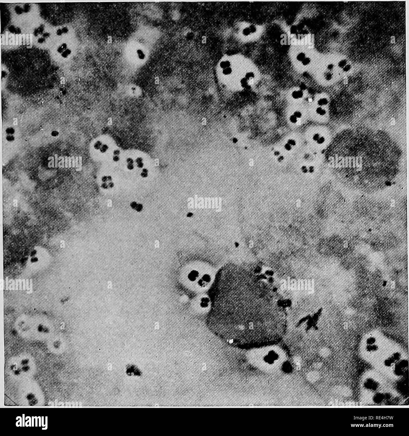 Normal Sputum