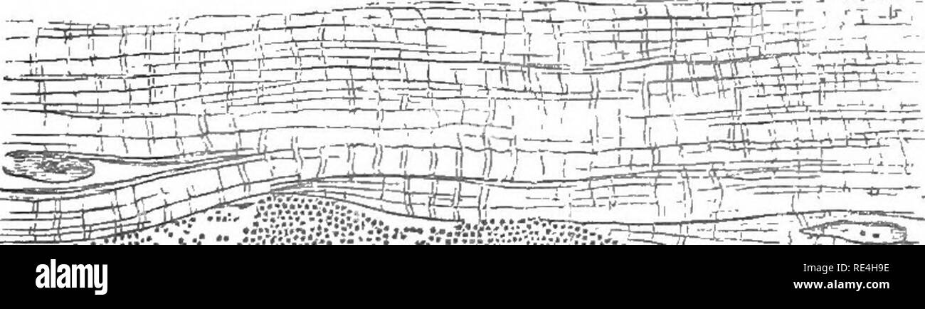 Pyaemia hi-res stock photography and images - Alamy