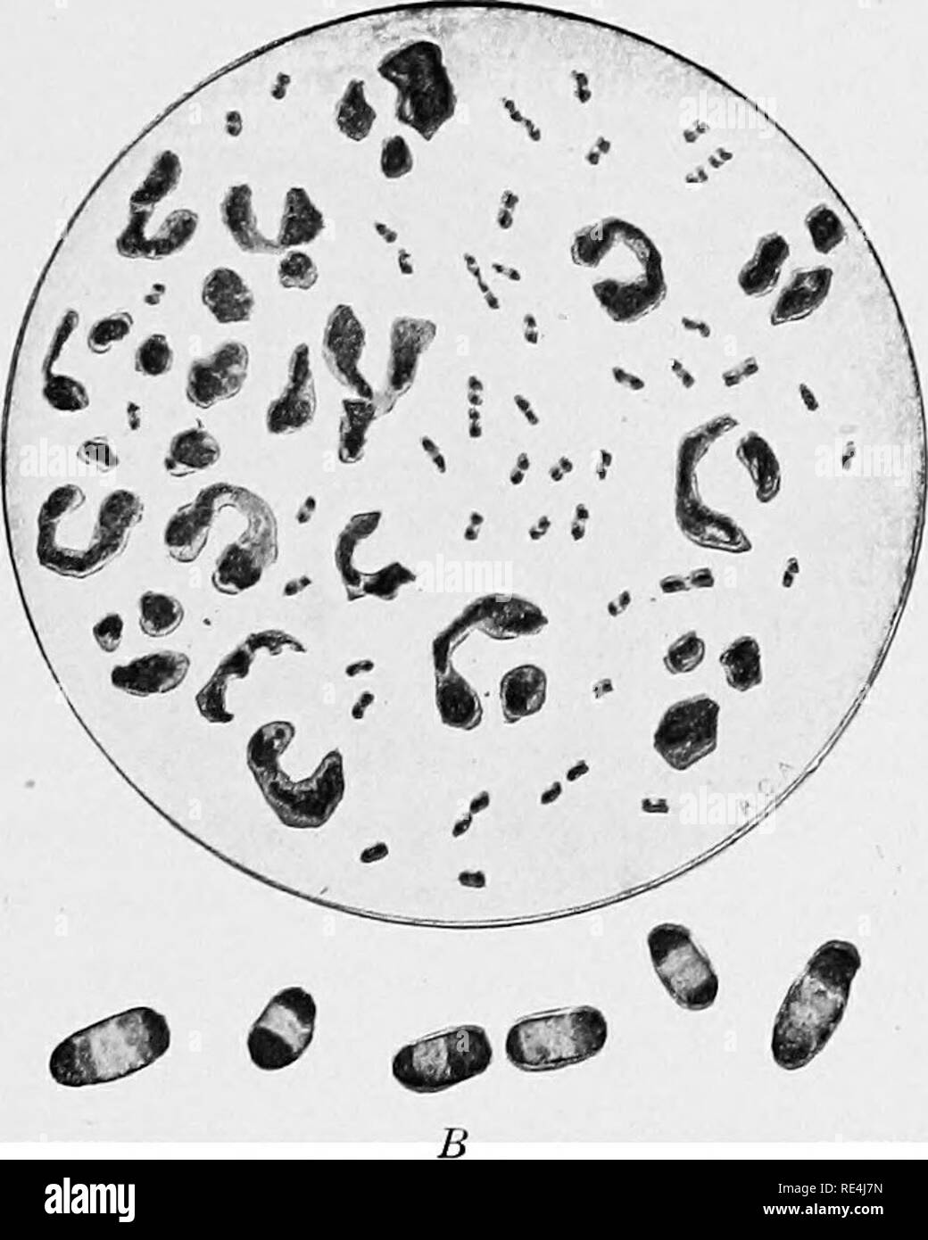 Bubonic plague bacillus hi-res stock photography and images - Alamy