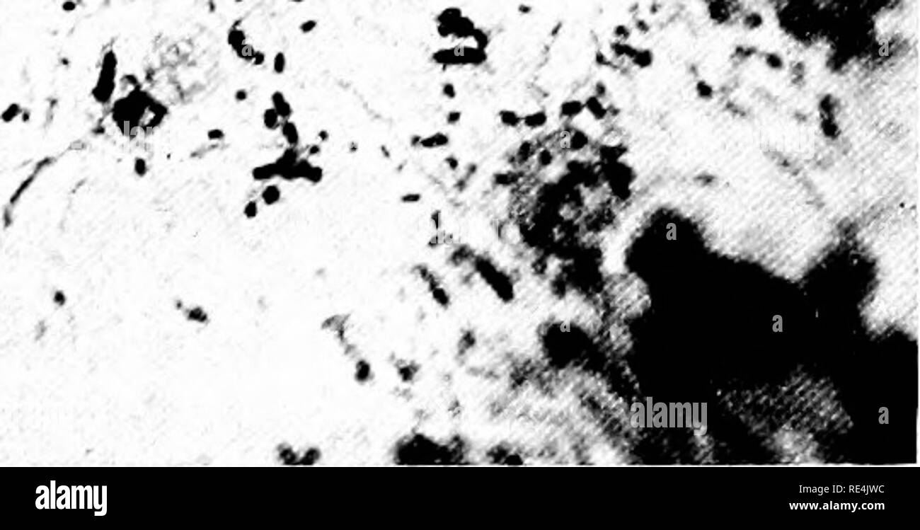 Angina de vincent hi-res stock photography and images - Alamy