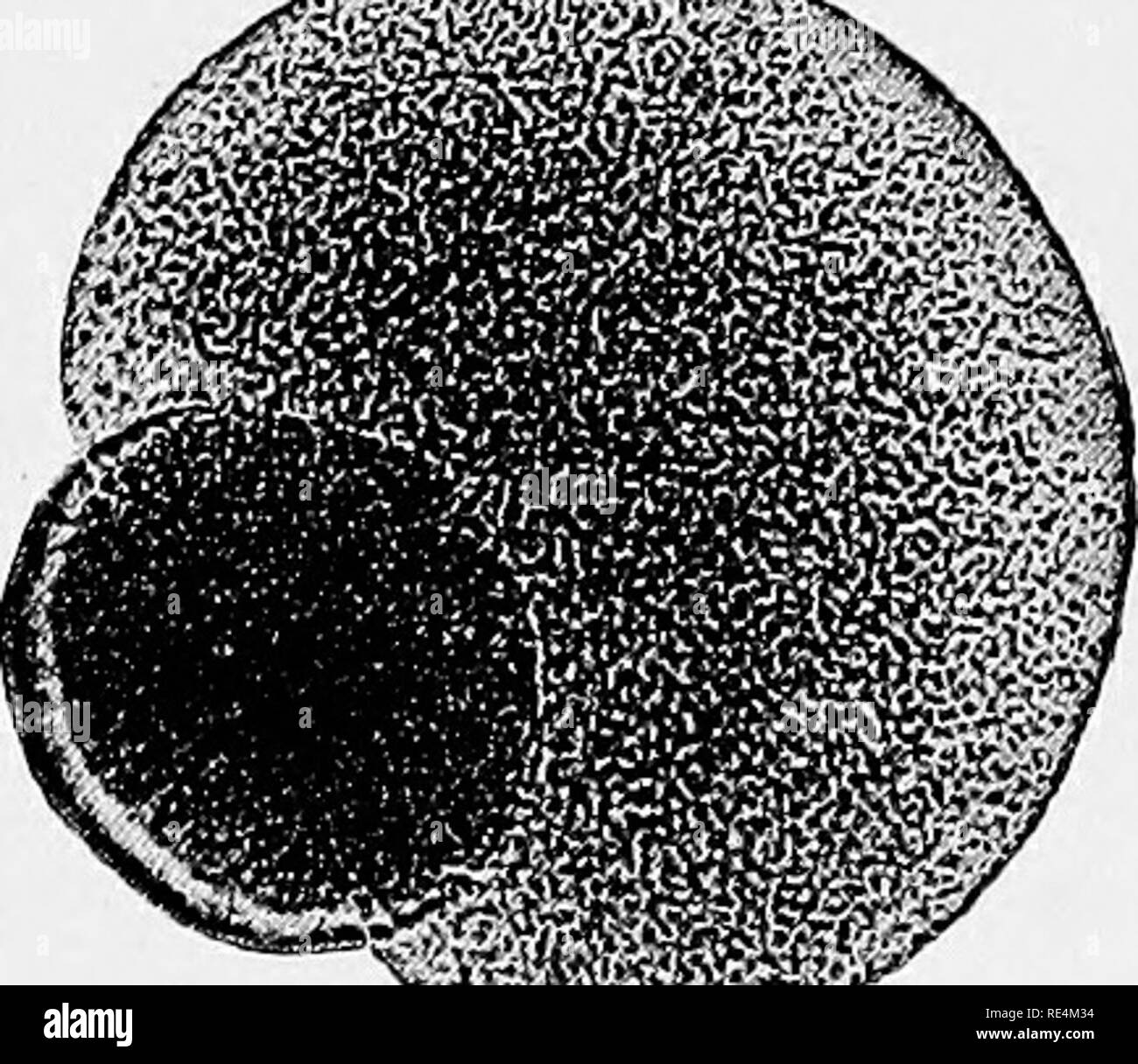 Cocci Bacteria Under Microscope