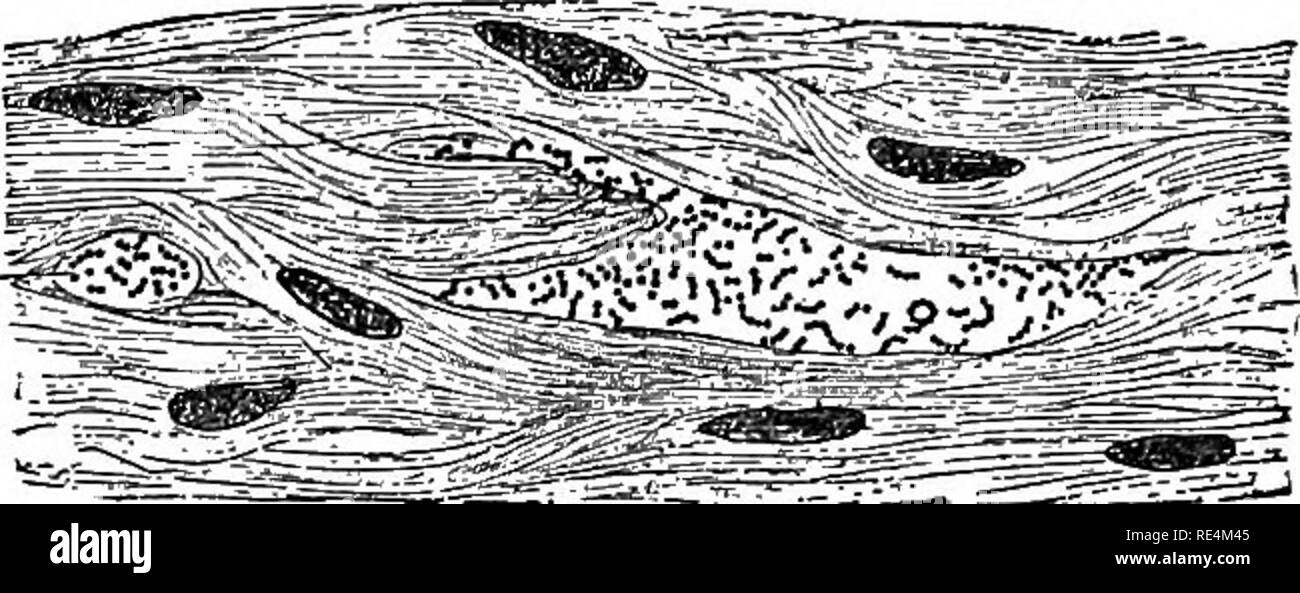 Streptococcus pyogenes bacteria Black and White Stock Photos & Images ...