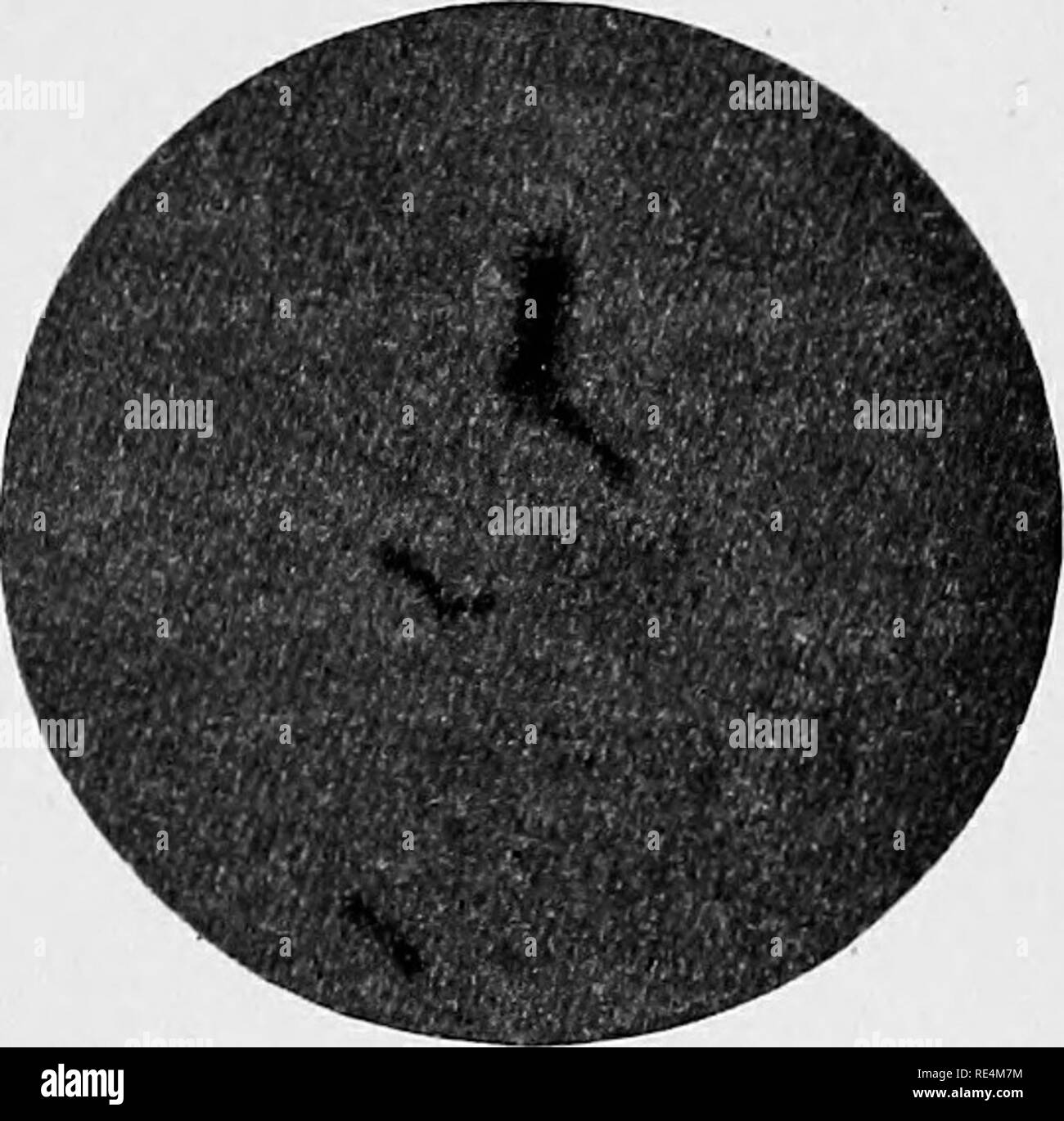 Bacillus anthracis capsule hi-res stock photography and images - Alamy