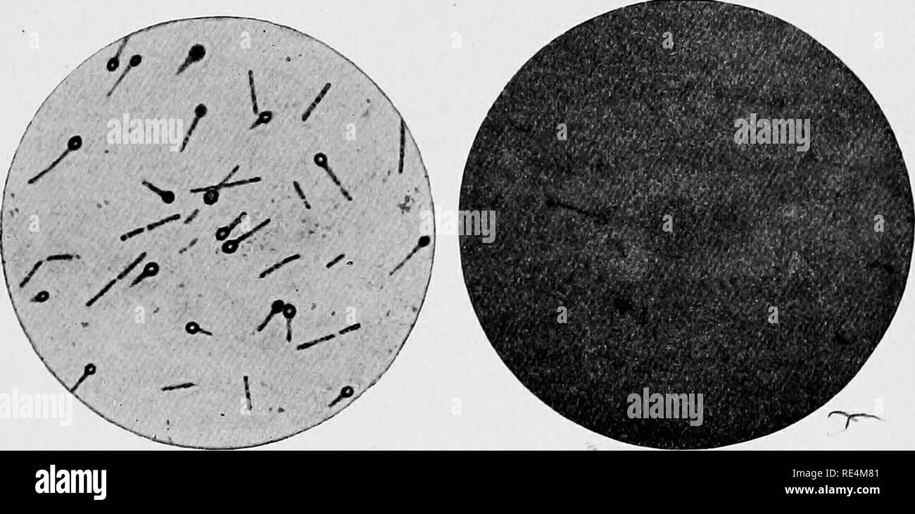 Tetanus bacillus Black and White Stock Photos & Images - Alamy