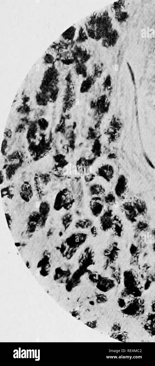 Take down swelling hi-res stock photography and images - Alamy