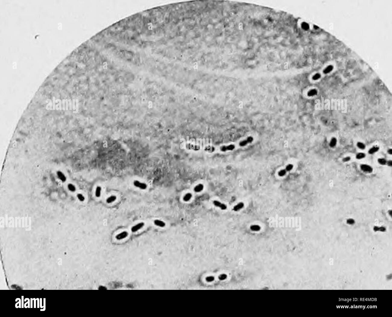 Streptococcus Pneumoniae Capsule Stain