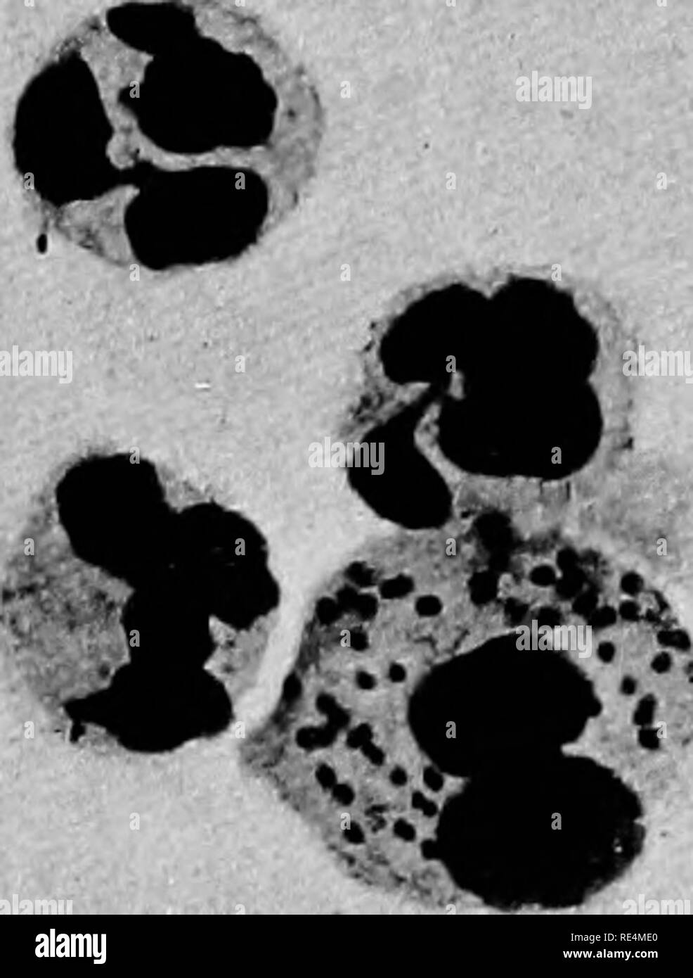 Potato injection Black and White Stock Photos & Images - Alamy