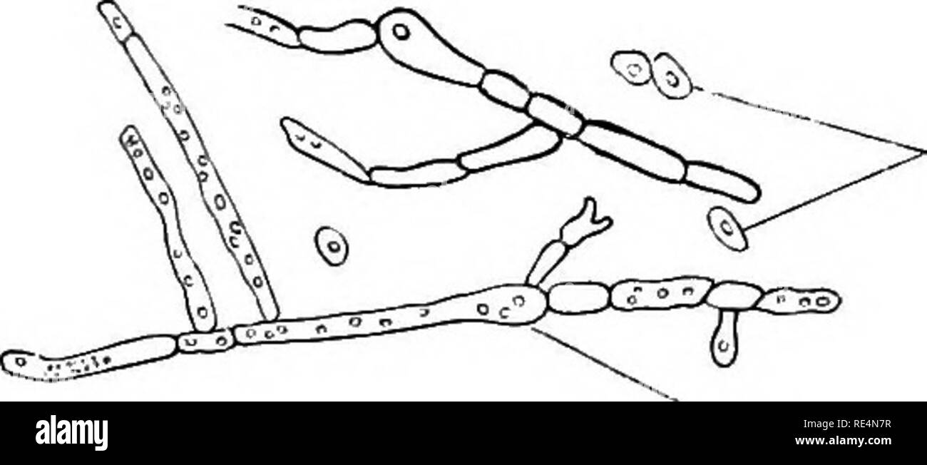 Albuminoid bodies hi-res stock photography and images - Alamy