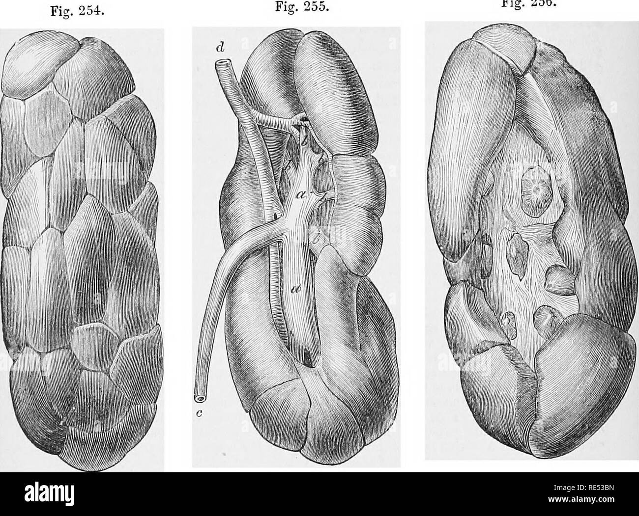 Ms anatomy Black and White Stock Photos & Images - Alamy