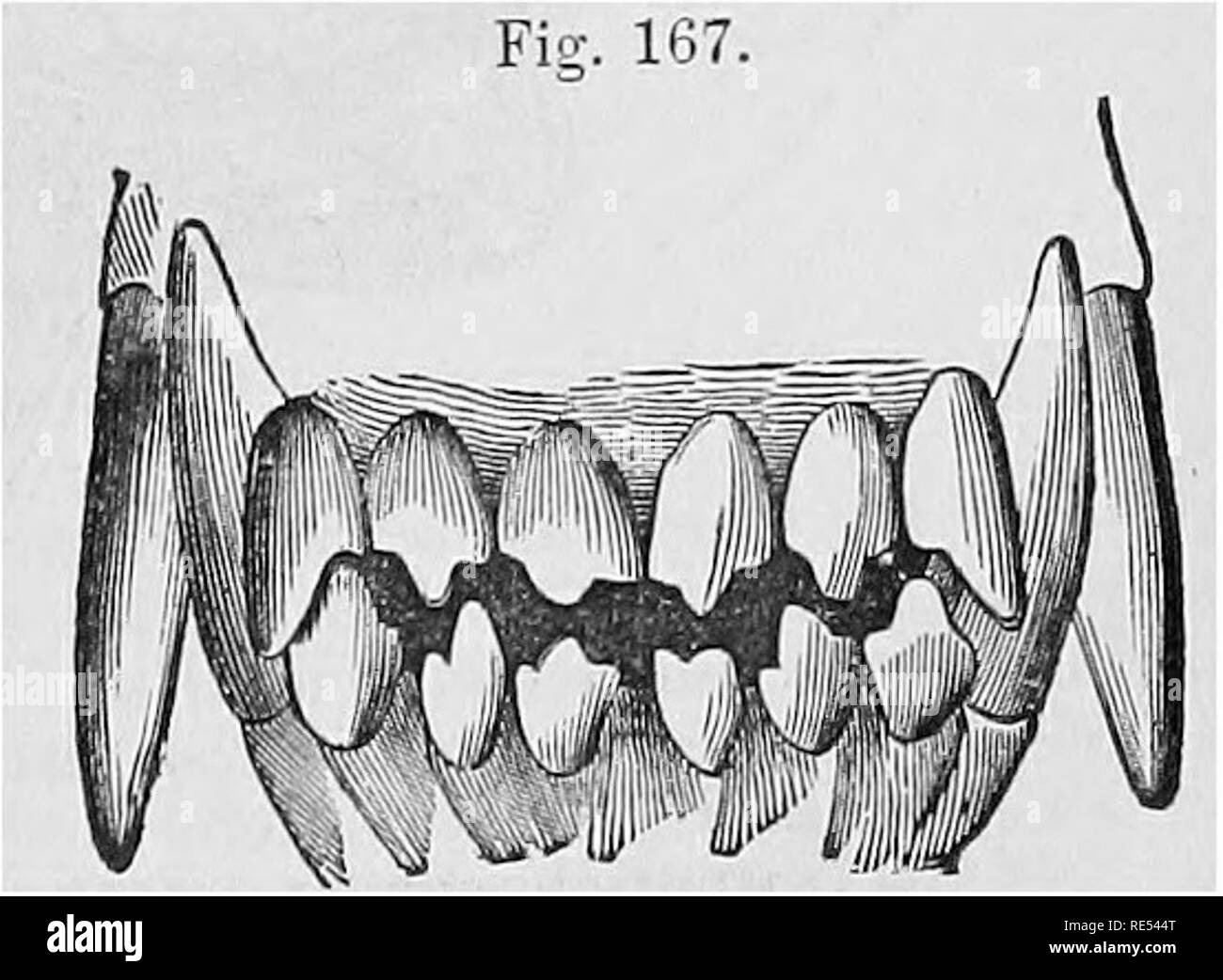 Permanent tooth eruption Black and White Stock Photos & Images - Alamy