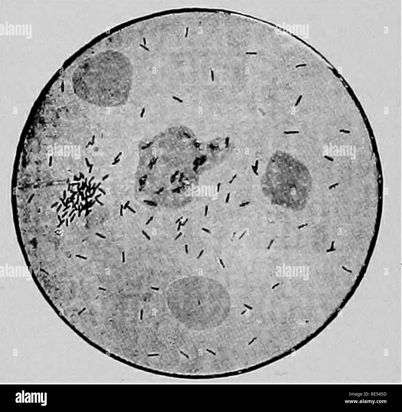 Swine erysipelas hi-res stock photography and images - Alamy