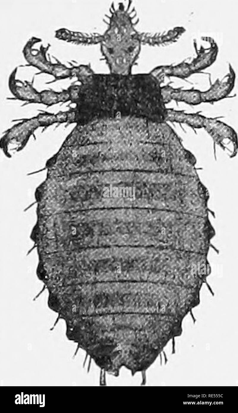 Body lice head lice Black and White Stock Photos & Images - Alamy