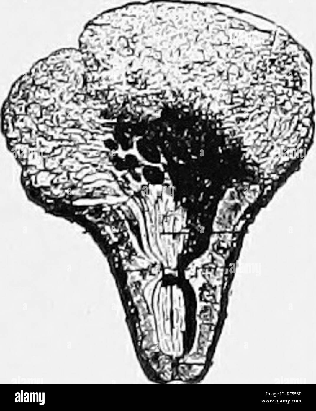 Mammary glands anatomy Black and White Stock Photos & Images - Alamy