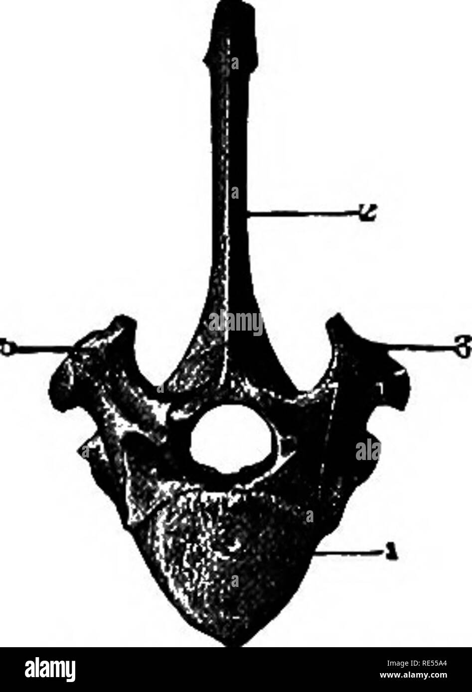 Transverse process of atlas Black and White Stock Photos & Images - Alamy