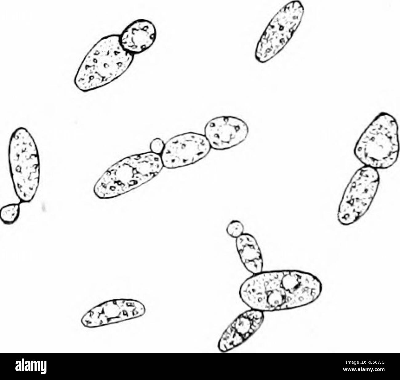 Yeast Contamination