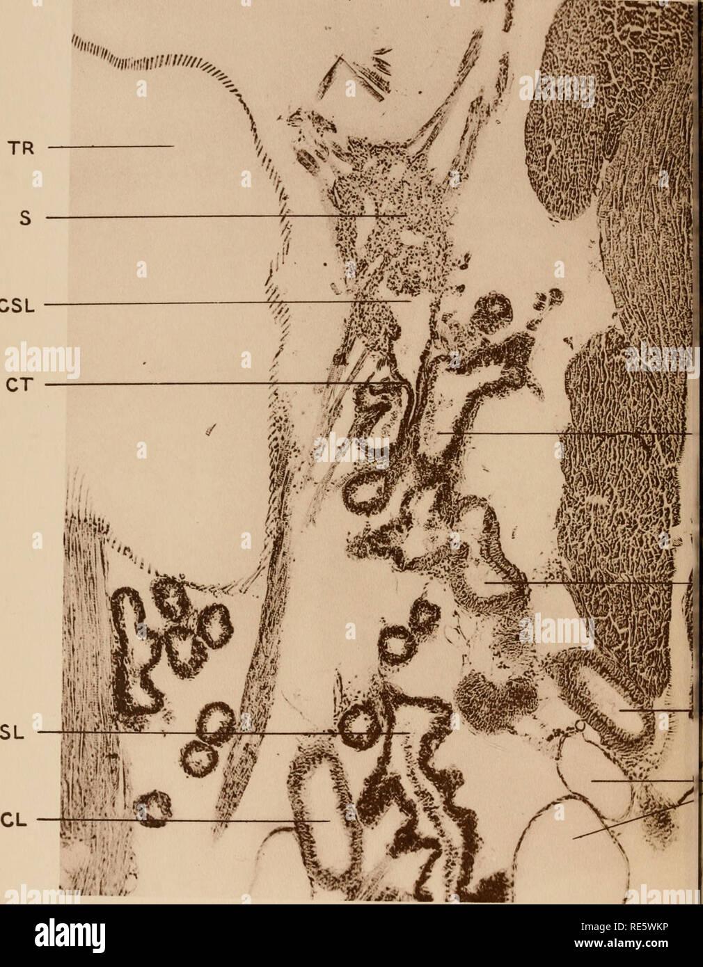 . Coxal glands of the arachnids. Arachnida -- Anatomy. Zoolog ...