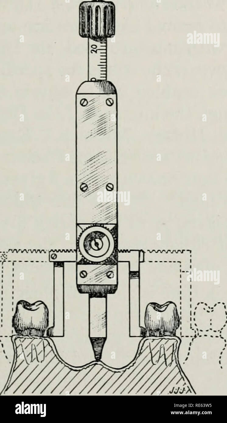 . Craniometry of Ambrym island. Craniology -- Ambrym island. TECHNIQUE ...